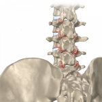 Infiltration des lombaires articulaires postérieures - Imagerie Médicale