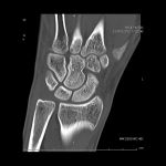 Scanner ostéoarticulaire - Imagerie Médicale
